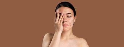 How to Spot Biotin Deficiency Disease & Prevent It